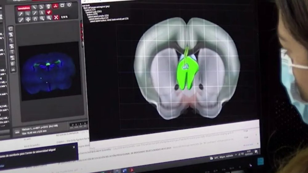 Una nueva cátedra de la ULPGC usa la inteligencia artificial para conocer el origen del alzhéimer